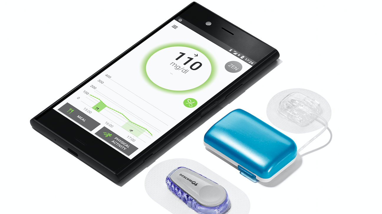 Diabeloop’s Automated Tech: What to Know