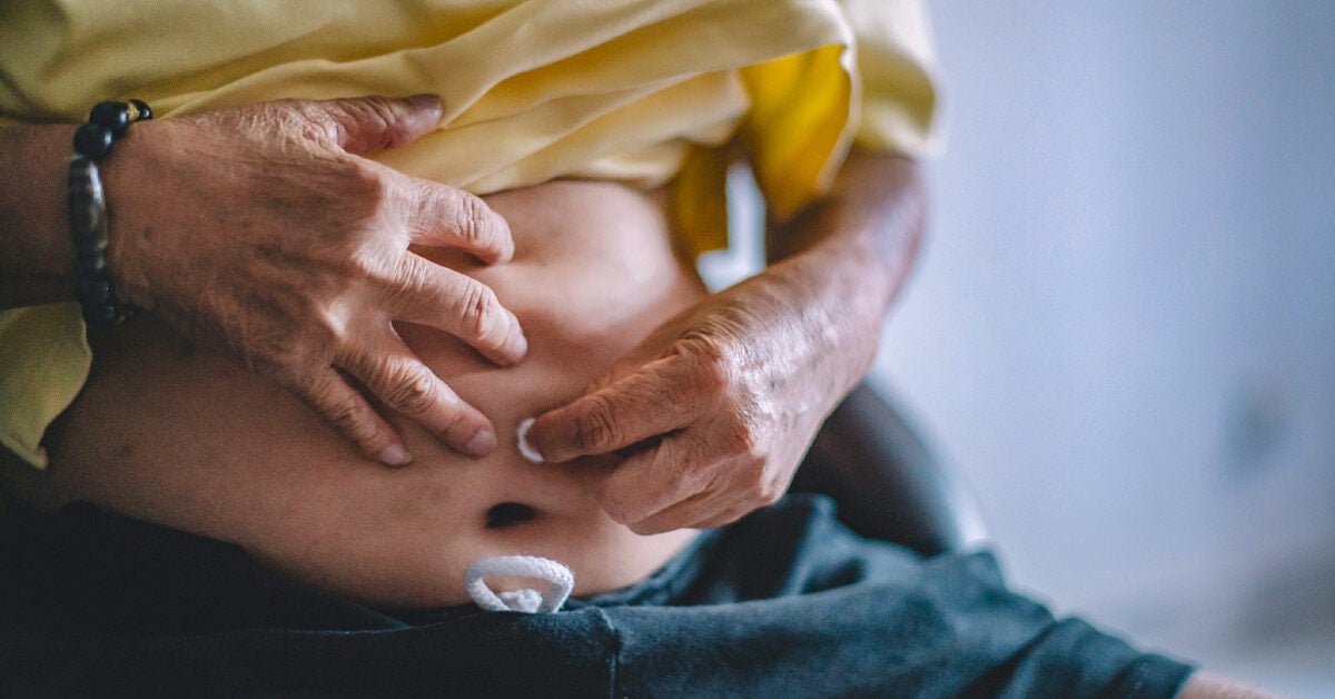 Belly Button Discharge: Causes, Treatment, Outlook, and More - Healthline