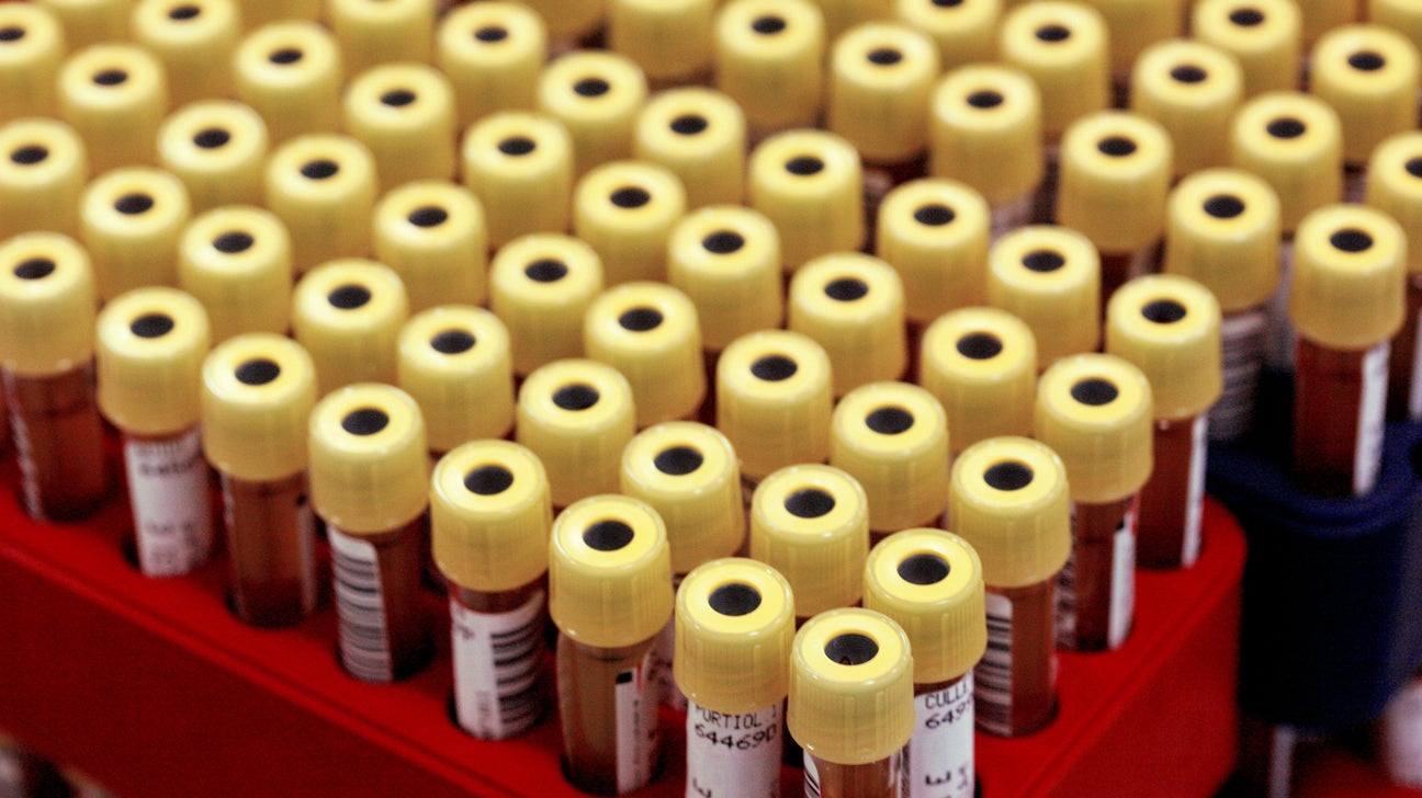 HDL Cholesterol: What It Is, and How to Boost Your Levels