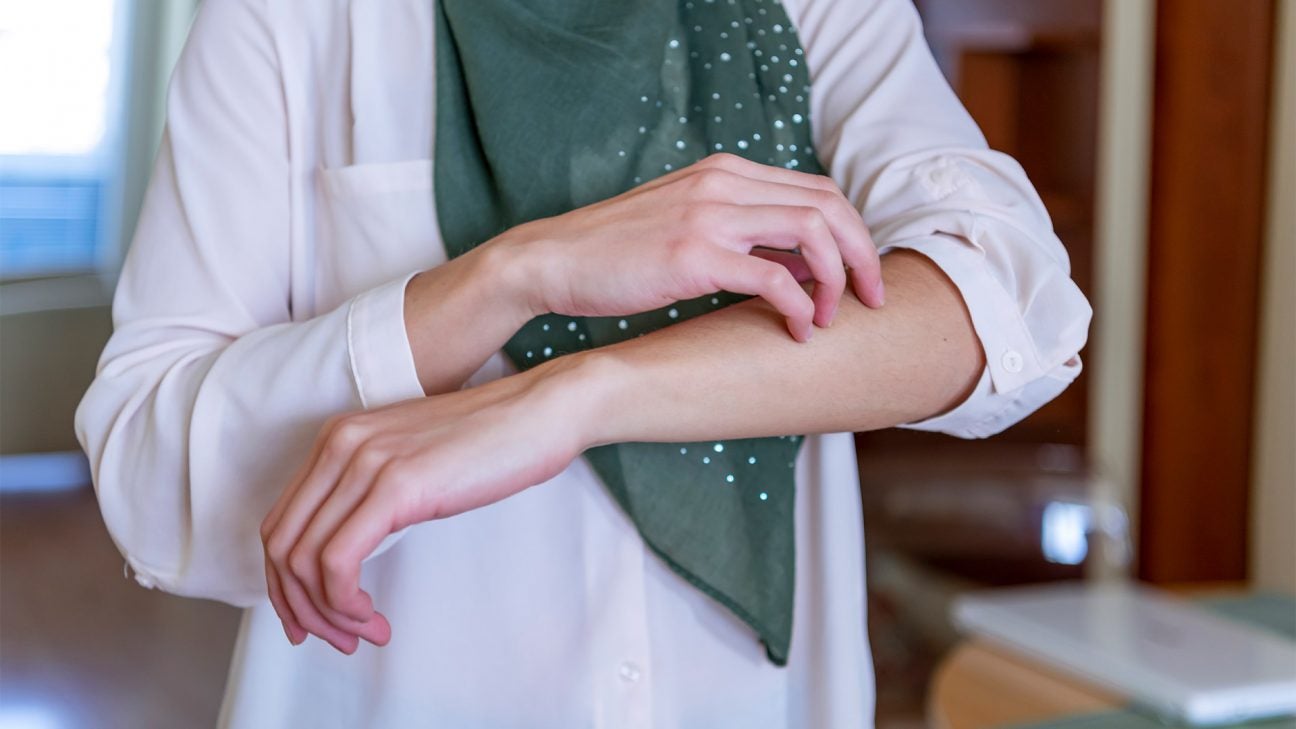 Shingles vs. Poison Ivy: How to Tell the Difference