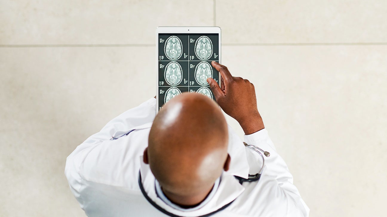 Why Would I Be Referred to a Neurologist?