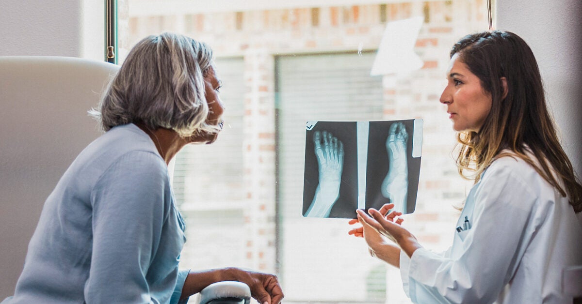 Osteopenia vs Osteoporosis: Differences, Treatment, Prevention & More