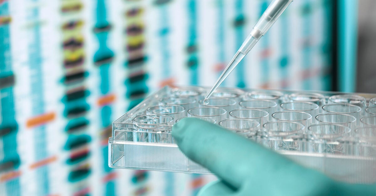 What You Need to Know about Philadelphia Chromosome ALL