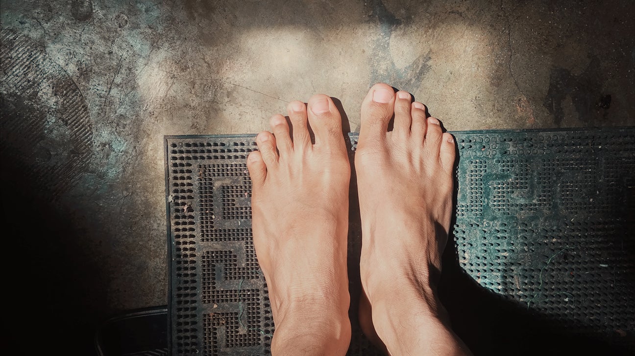 Gout Symptoms and Flare-ups