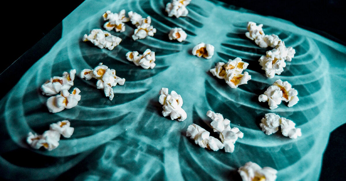 Popcorn Lung: Symptoms, Causes, Treatment, Prevention