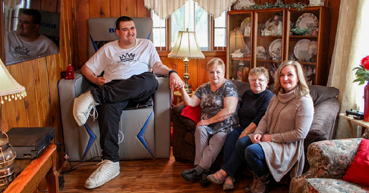 Acromegaly Vs Gigantism Symptoms Causes Diagnosis More