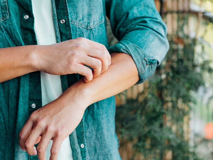 Atopic Dermatitis: Symptoms, Causes, Types, Risks, and More