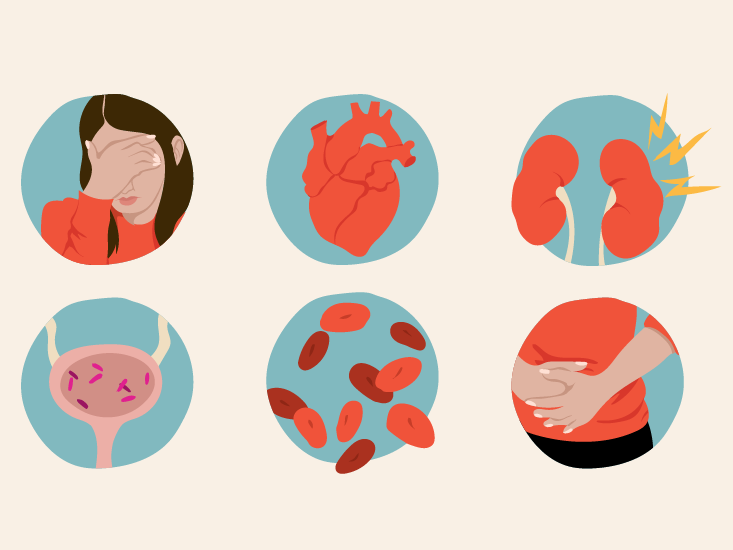 Common ADPKD Symptoms: Pain, Kidney Stones, and More