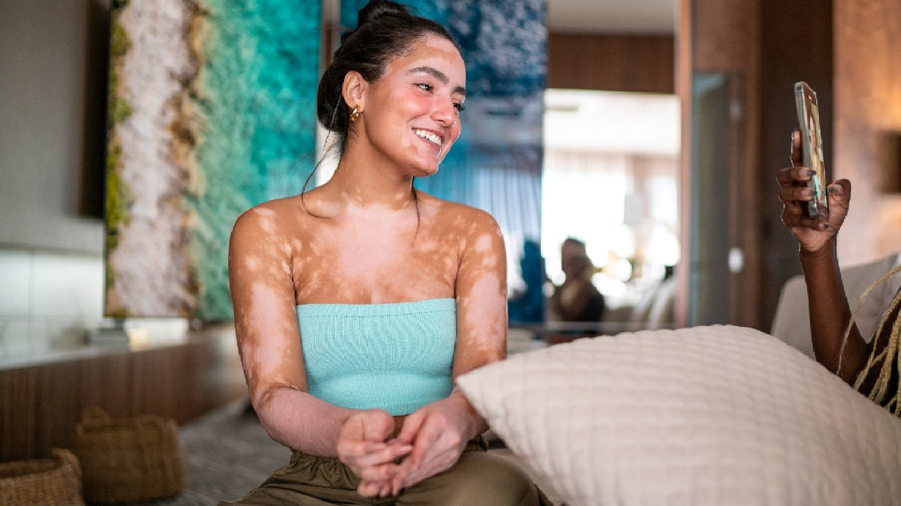 What Does Vitiligo Look Like? Vitiligo Pictures and More