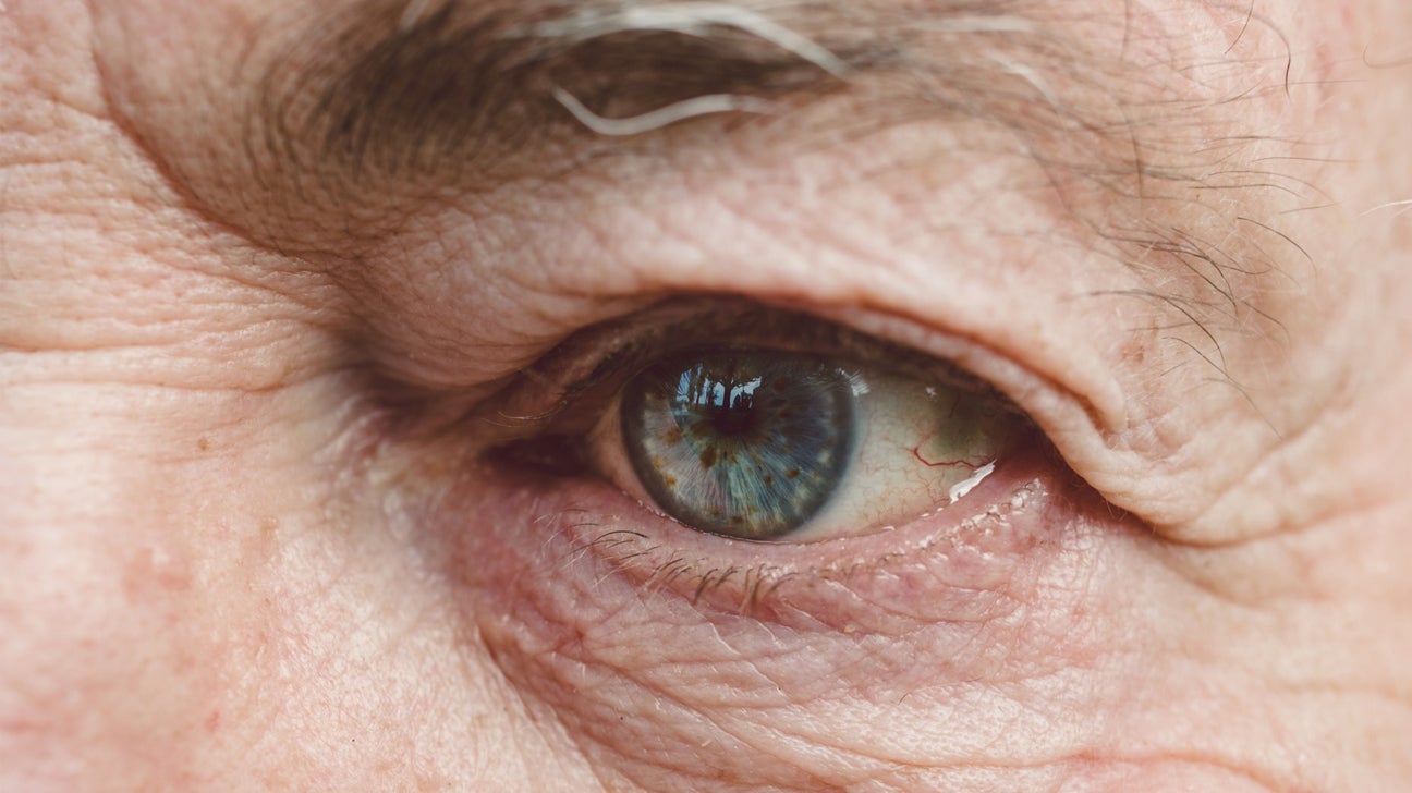 FDA Approves New Drug for Macular Degeneration