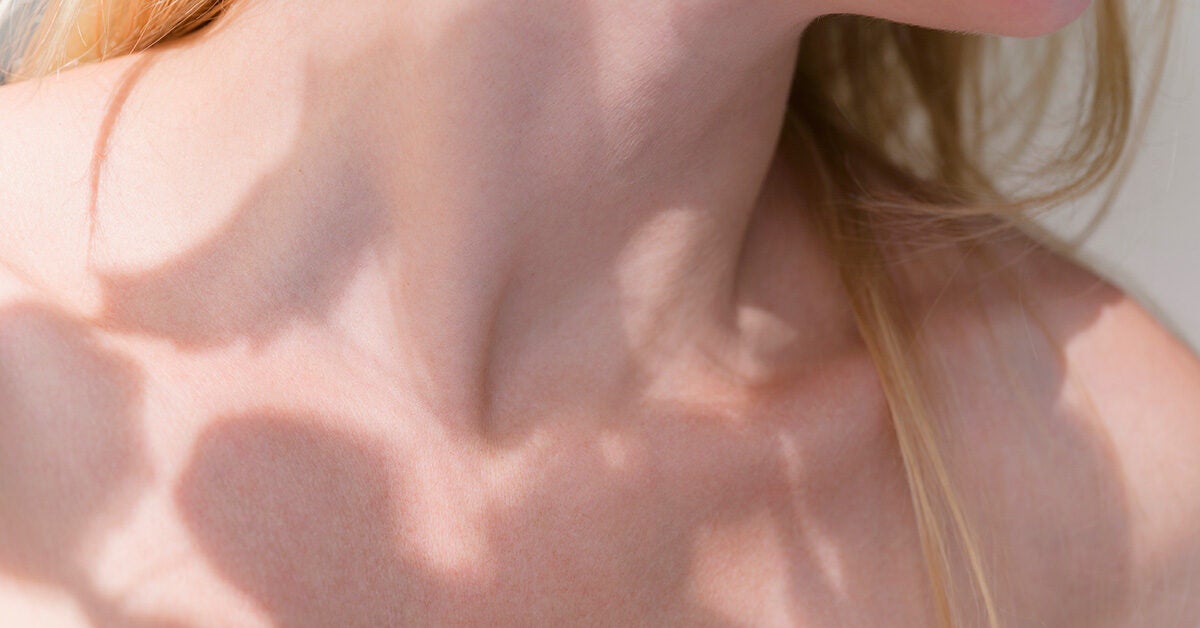 Hyperthyroidism: Causes, Symptoms, Treatment, Diagnosis & More