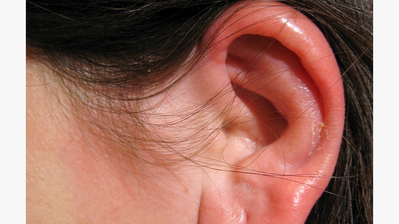 Rash and Skin That Feels Hot to the Touch: Causes and Photos