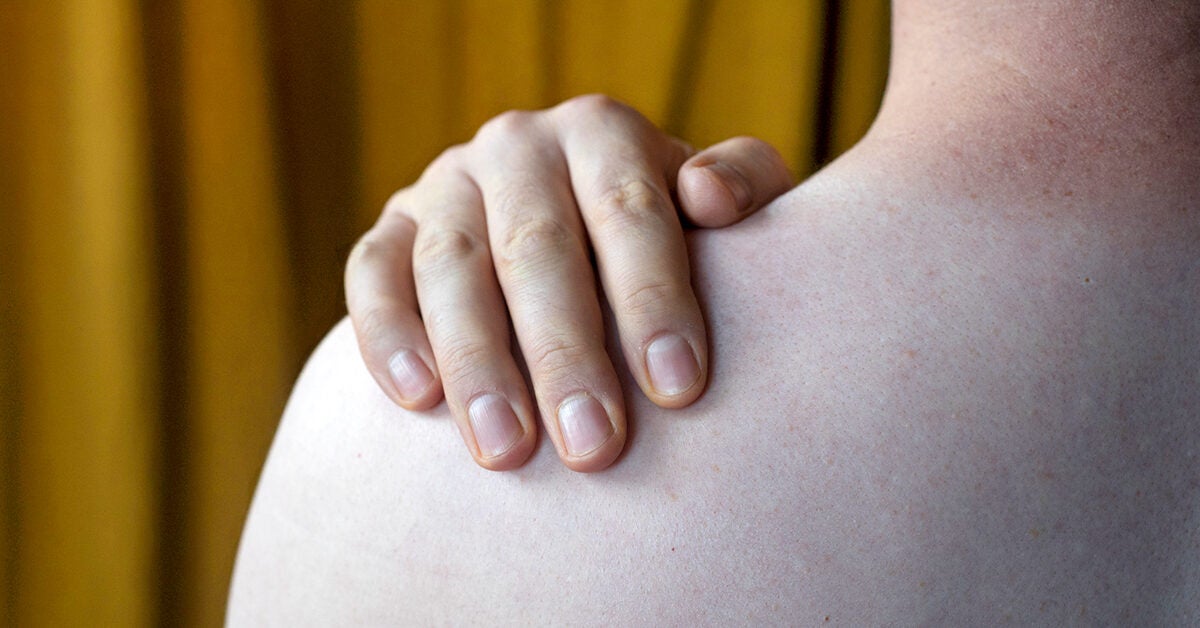 Chronic Lymphocytic Leukemia Skin Lesions: Causes and Types