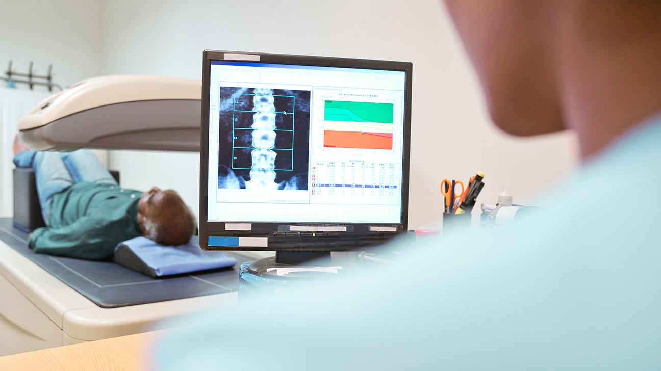 Will a Bone Density Scan Help Treat My Osteoporosis?