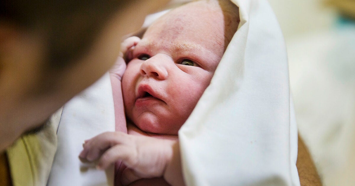 Hypospadias: What It Is, Diagnosis, Treatment, and More