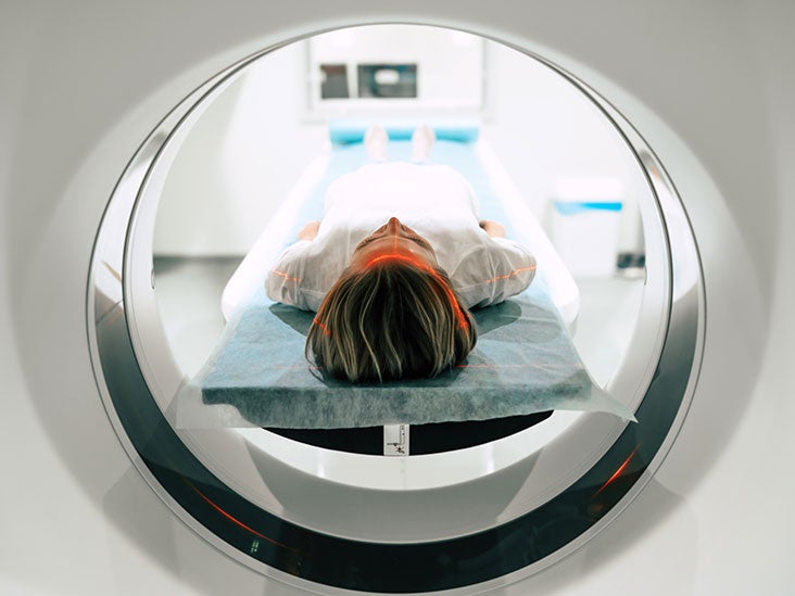 Non-Small Cell Lung Cancer Metastasis to Bone: Treatment, Outlook