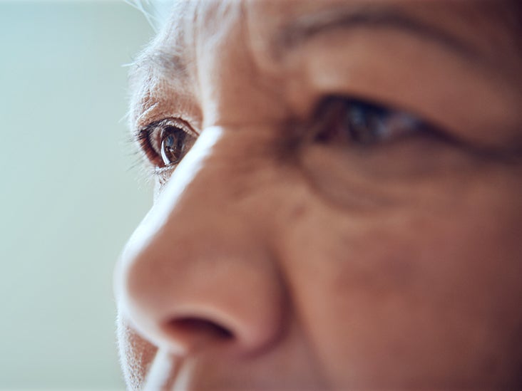 How Does Arthritis Affect the Eyes?