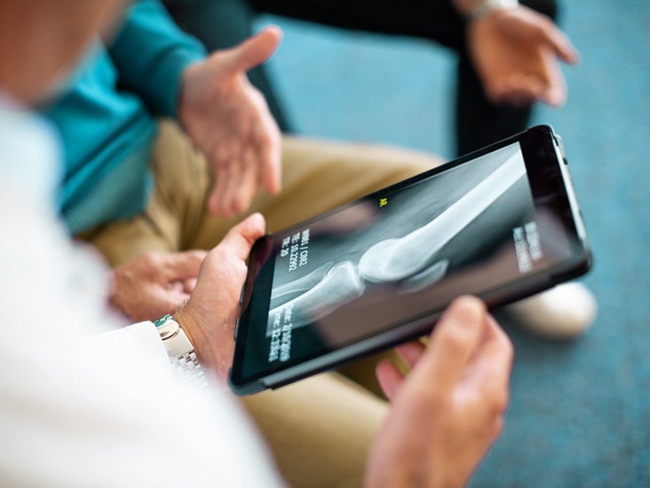 Primary vs. Secondary Osteoarthritis: What’s the Difference?