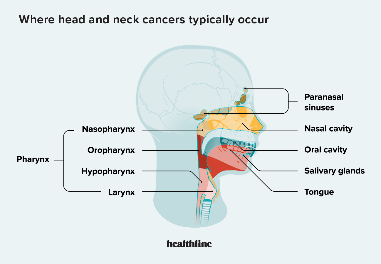 Differential Diagnosis Of Head And Neck Cancer At Susanne Lumpkin Blog Differential Diagnosis Of Head And Neck Cancer At Susanne Lumpkin Blog