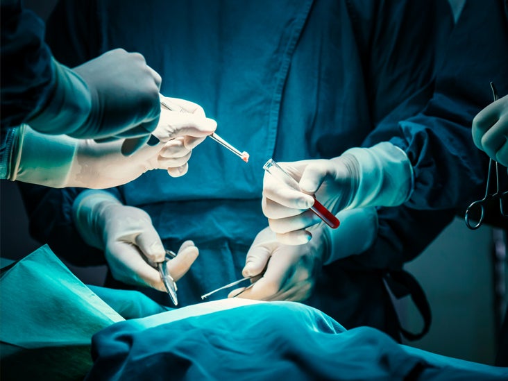 Transjugular Liver Biopsy Procedure: Technique, Safety, Recovery