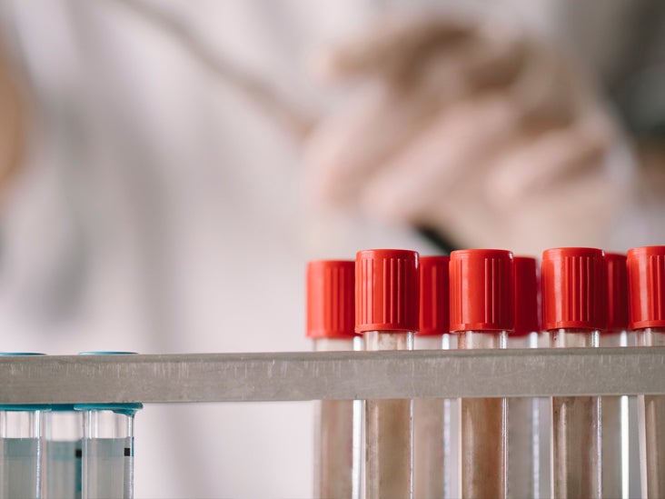 Lymphoproliferative Disorders: Symptoms, Treatment, Outlook, and More