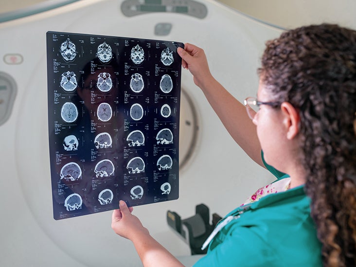 Chiari Malformation Surgery: Candidates, Procedure, Recovery, and More