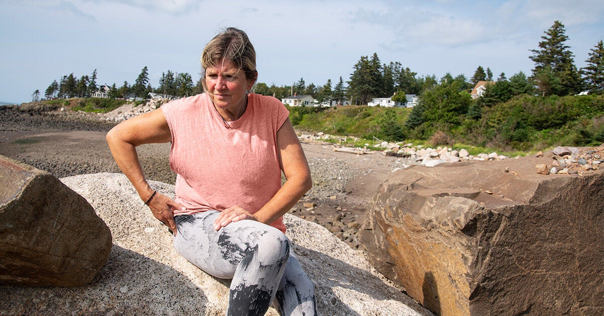 Hip Impingement: Causes, Symptoms, Treatment, and More