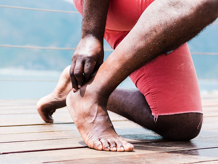 Ruptured Achilles Tendon: Diagnosis, Treatment, and More