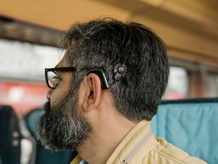 Why Cochlear Implants Are Bad: Exploring the Controversy