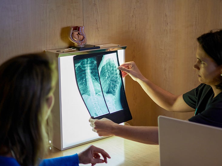 Schmorl’s Nodes: Causes, Diagnosis, and Treatment