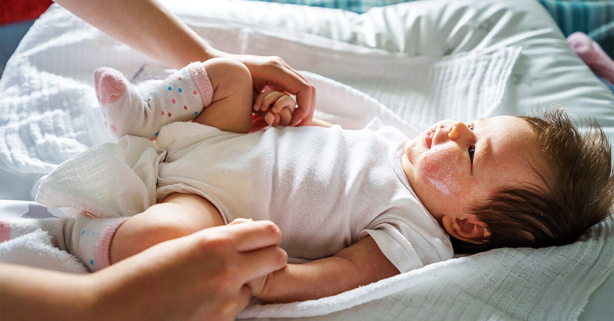 This Treatment For Eczema Can Help Infants and Young Children