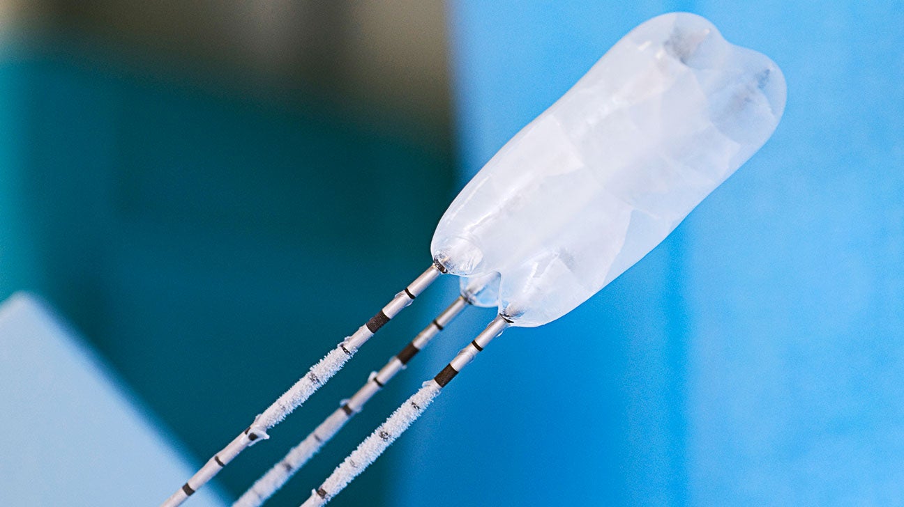 Cryotherapy for Prostate Cancer: Efficacy, Side Effects, More