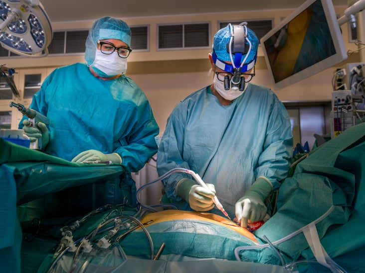 Annuloplasty for Heart Valve Repair: Procedure and Recovery