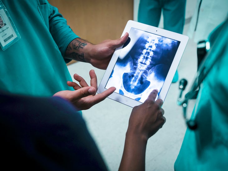 Lumbar Laminectomy What To Expect After Surgery