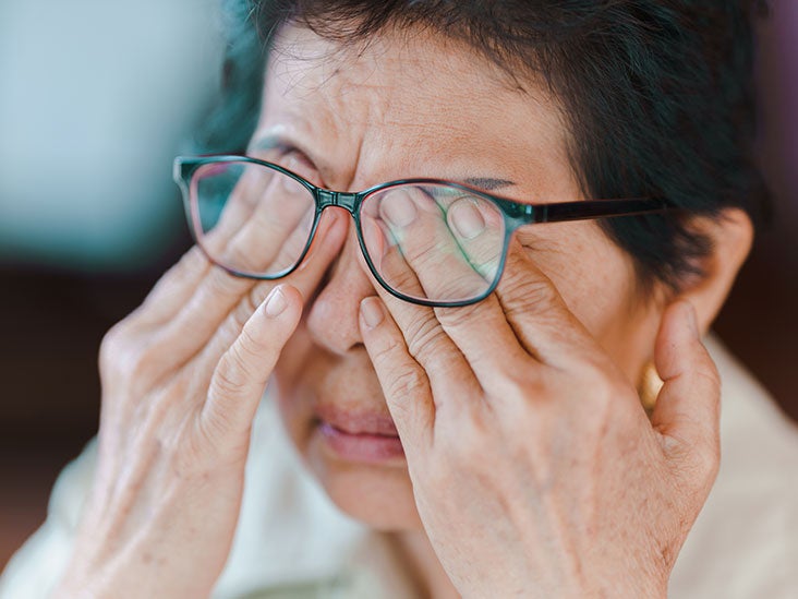 Blepharitis Vs. Dry Eye Syndrome: Does One Cause the Other?