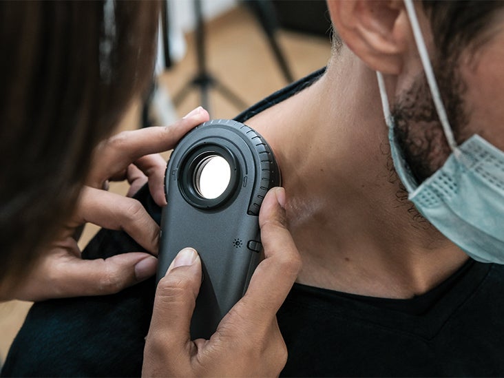 Skin Cancer: Immunotherapy Drug Shows Promise