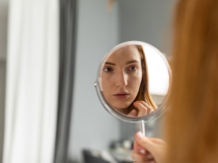 Blepharitis vs. Stye: Symptoms, Causes, and Treatment