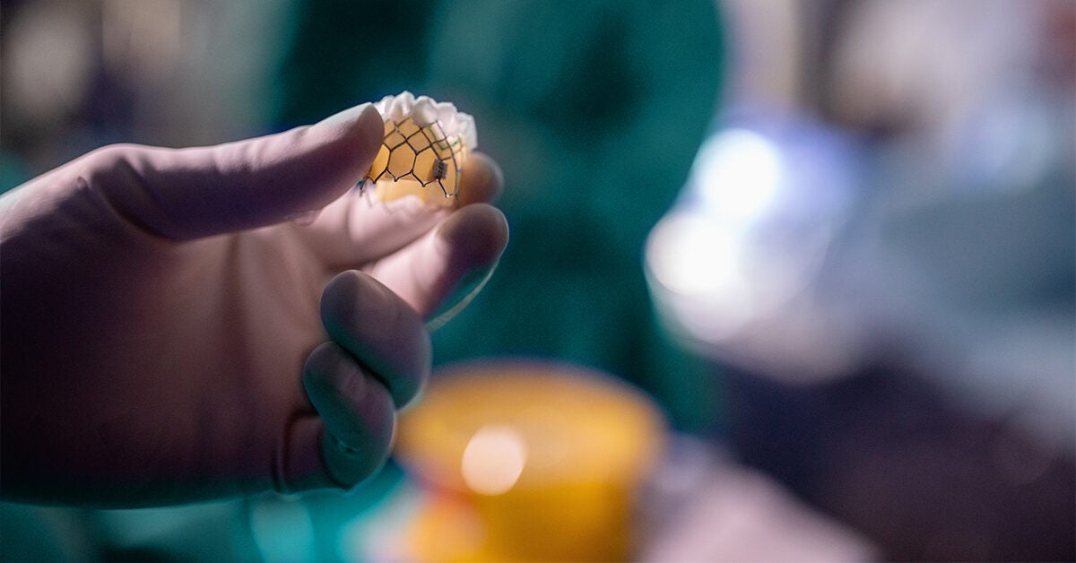TAVR Procedure: Benefits, Risks, Recovery, Effectiveness