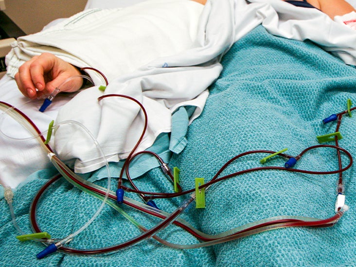 Acute Myeloid Leukemia (AML) Bone Marrow Transplant