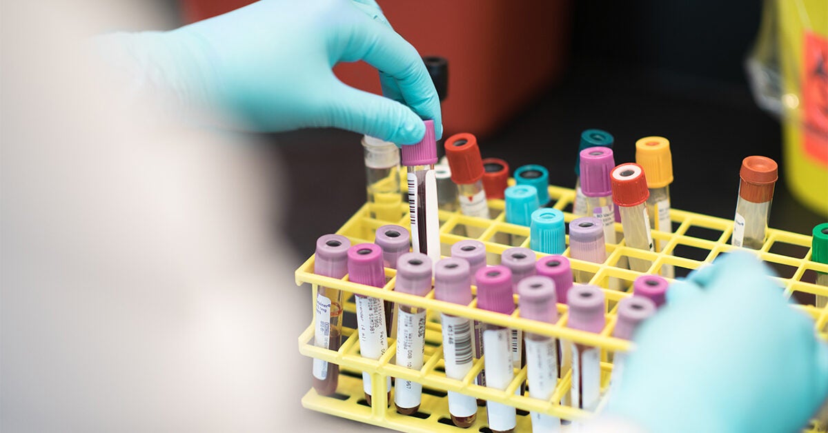 Blood Tests for Endometriosis: 5 Things to Know