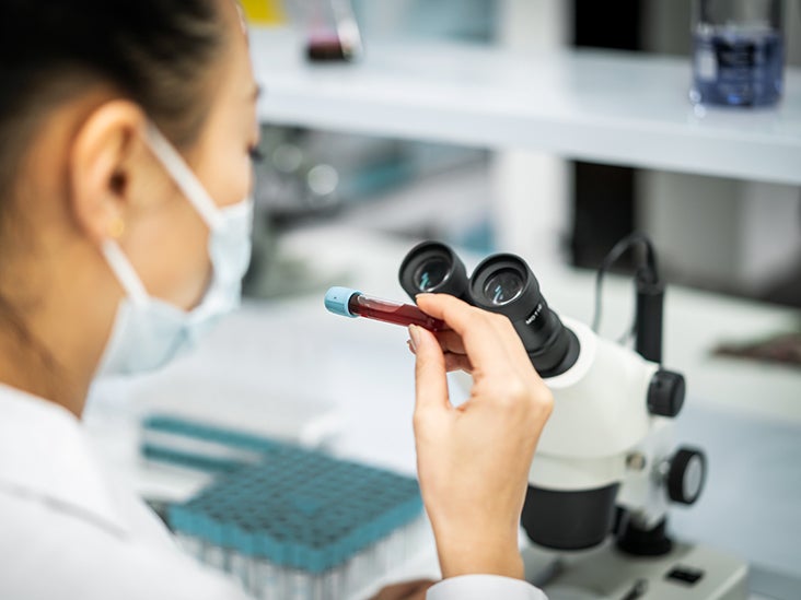 Is There a Test for Shingles?