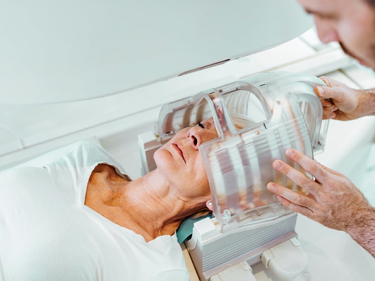 Bone Cancer In The Skull Types Symptoms And Survival