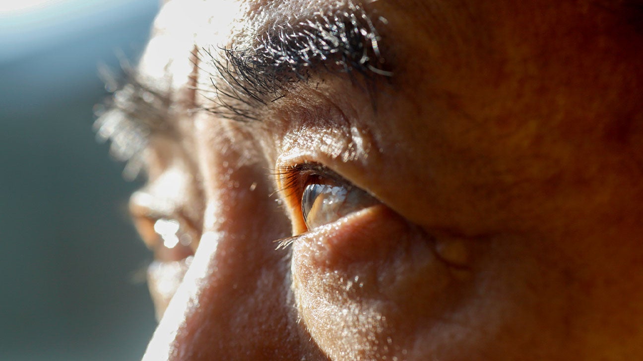 What Is the Usual Age of Onset for Macular Degeneration?