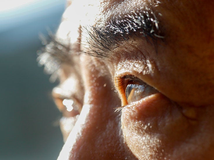at-what-age-does-macular-degeneration-usually-start-developing