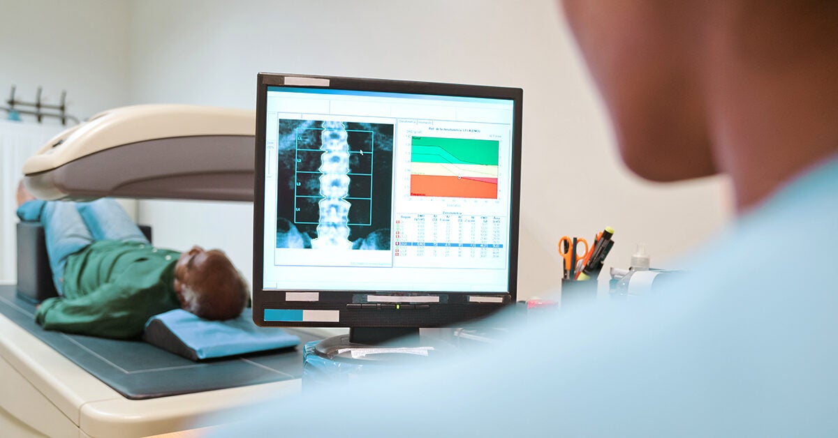 Bone Scan for Osteoporosis: Purpose, Procedure, Results, Cost
