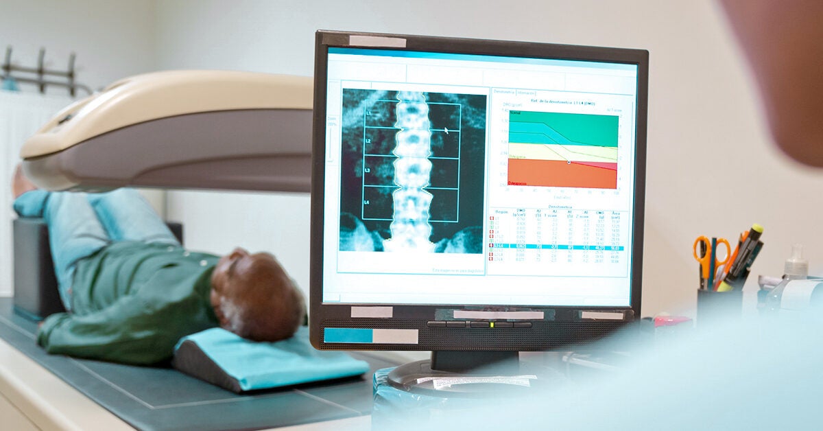 T-Score Vs. Z-Score for Osteoporosis: What the Results Mean