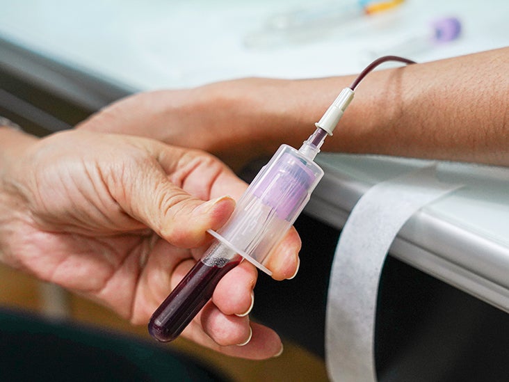 Does a High MCV (Mean Corpuscular Volume) Mean You Have Cancer?