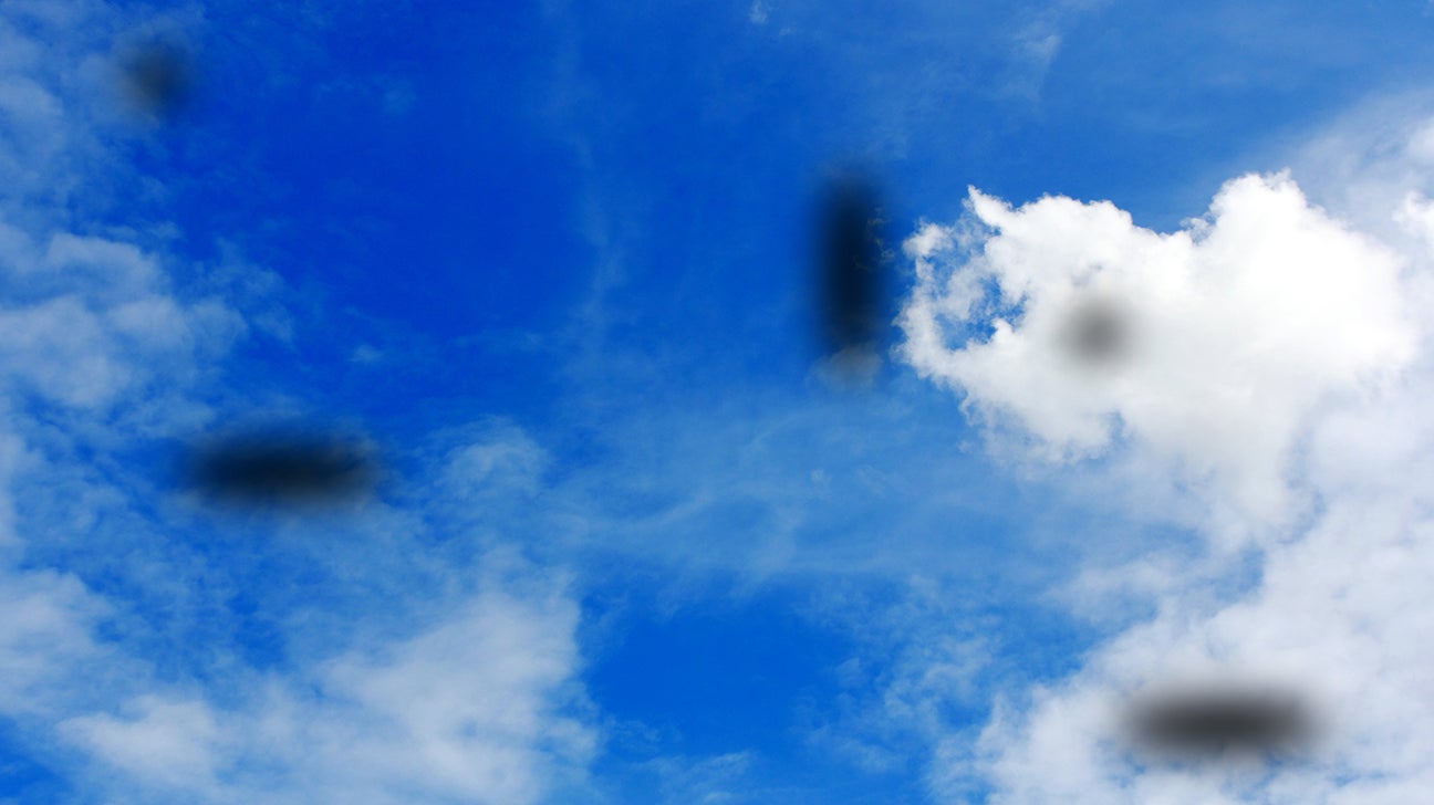 How Does Diabetic Retinopathy Affect Your Vision?