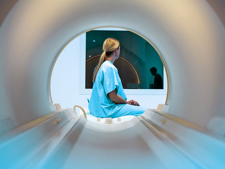 Ulcerative Colitis and CT Scans