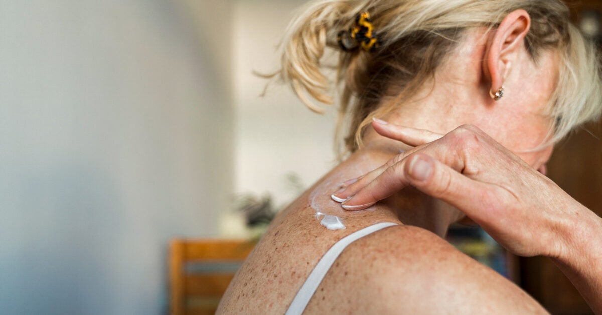 Shingles Itching After Rash Is Gone: Causes and Treatment